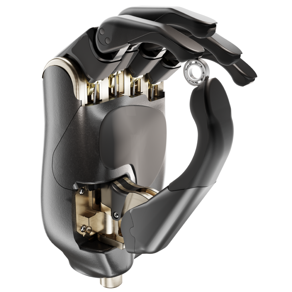 Metacarpal: The first bionic hand solely powered and controlled through ...